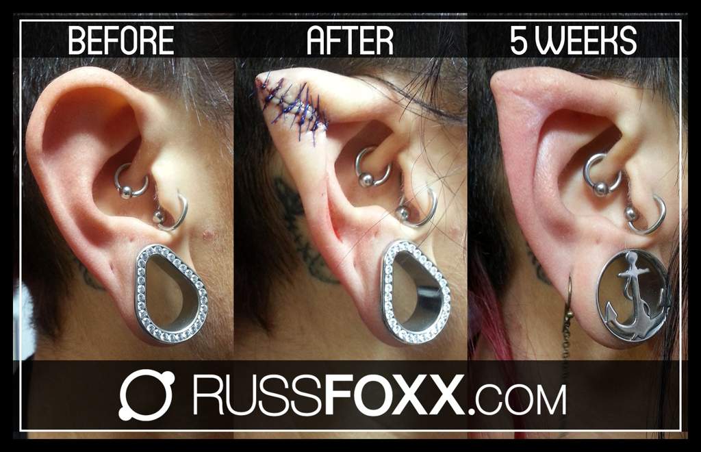 Le Ear Pointing Wiki Tatouages Piercings FR Amino