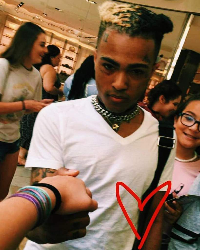 ๐ค๐๐ฒ๐ท๐ฐ ๐ป๐ฒ๐ญ๐ญ๐ฎ๐ท ๐ช๐ท๐ฐ๐ฎ๐ต๐ค Xxxtentacionfans Amino